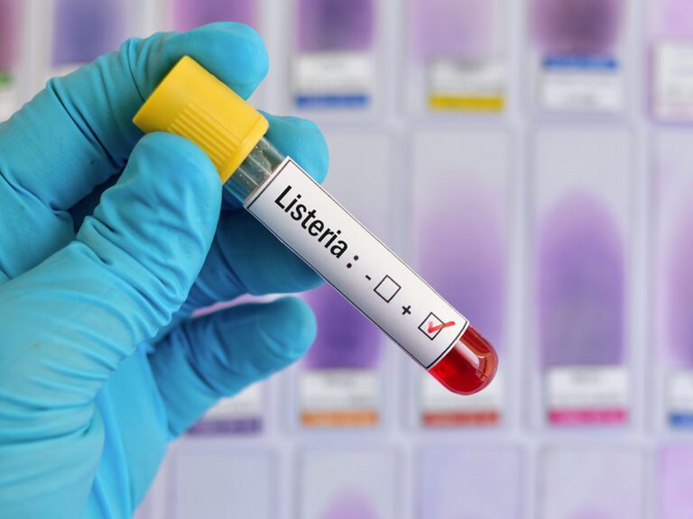 Understanding the updated Listeria Policy (Canada) - Sirocco